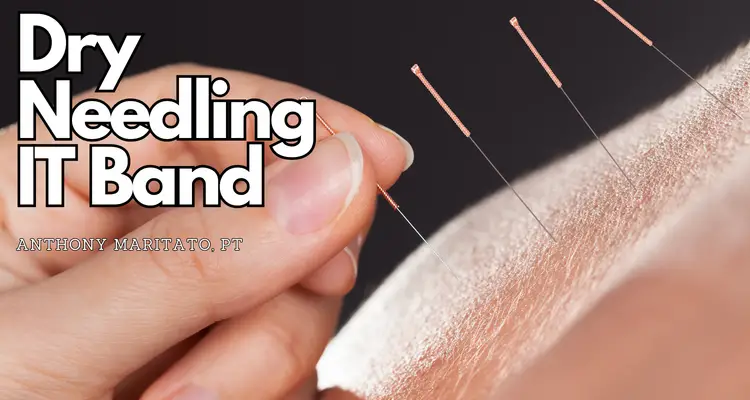 Dry Needling for IT Band Syndrome